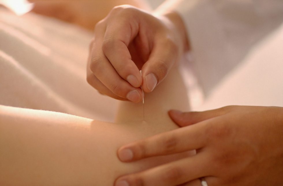 Why Acupuncture Is Good for Your Kids