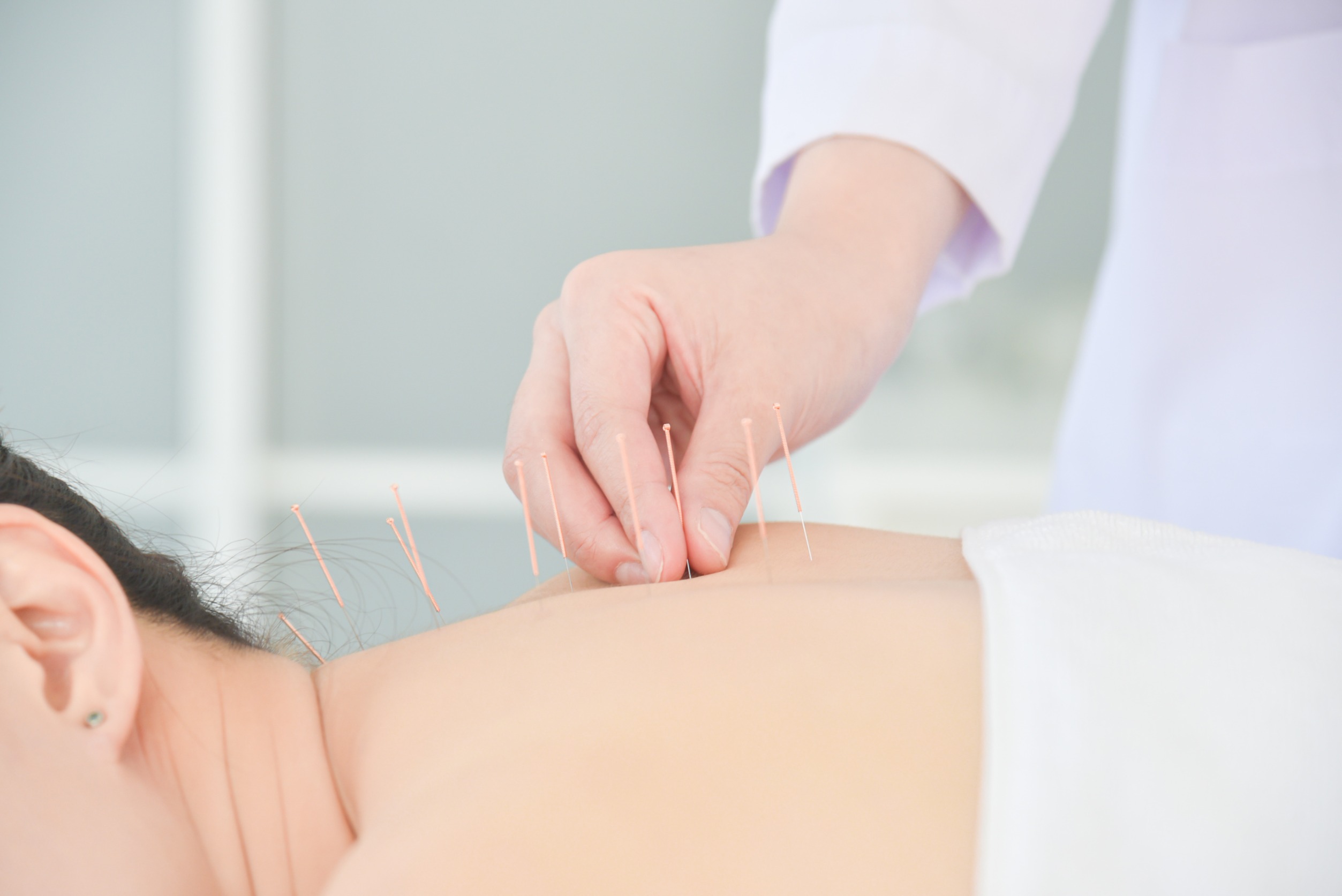 Importance of Choosing a Registered Acupuncturist